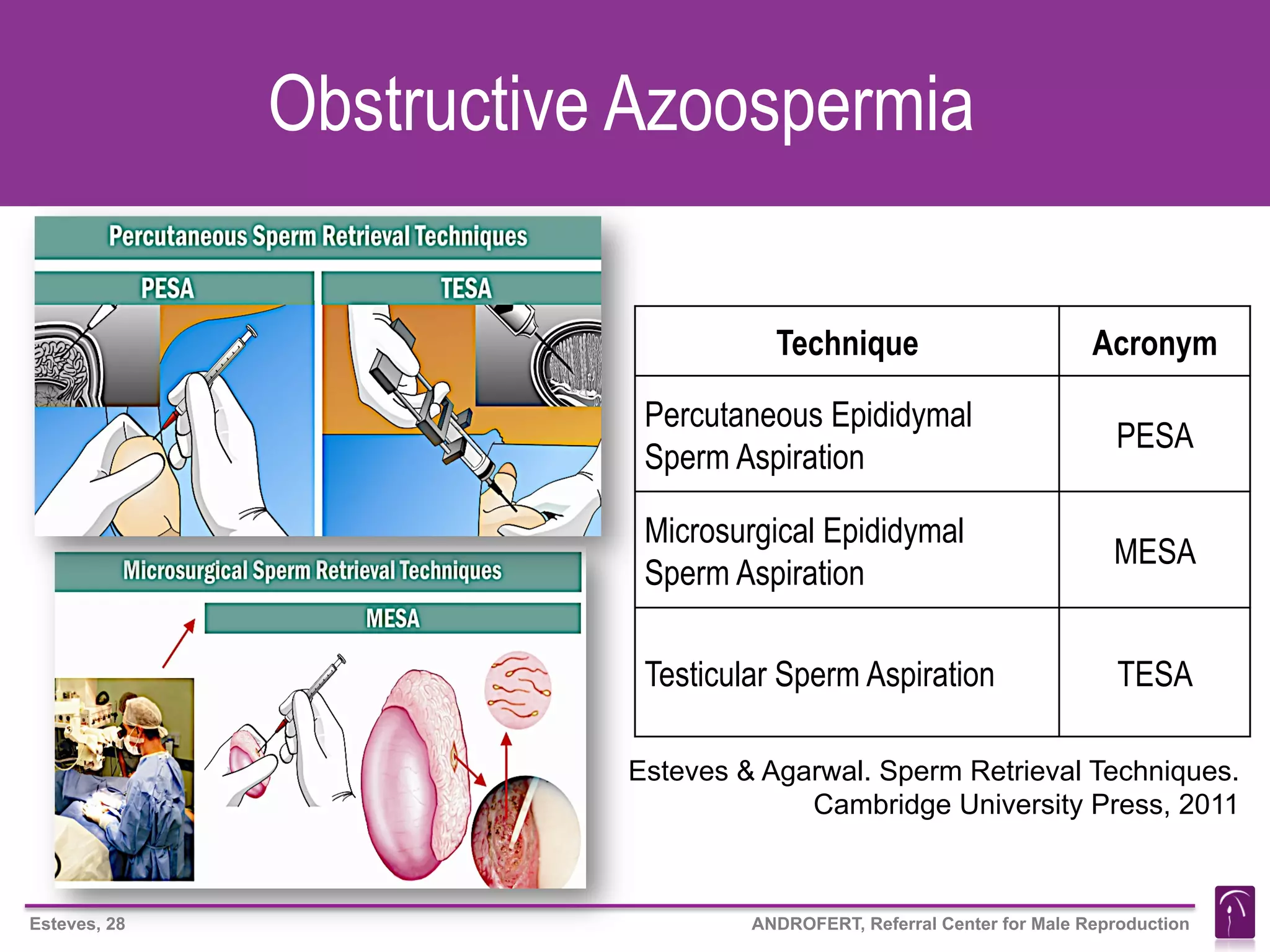 Management of Male Infertility | PDF