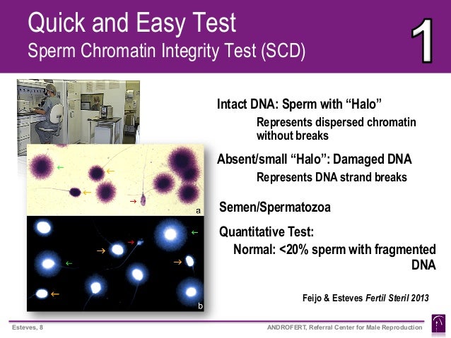 Management Of Male Infertility