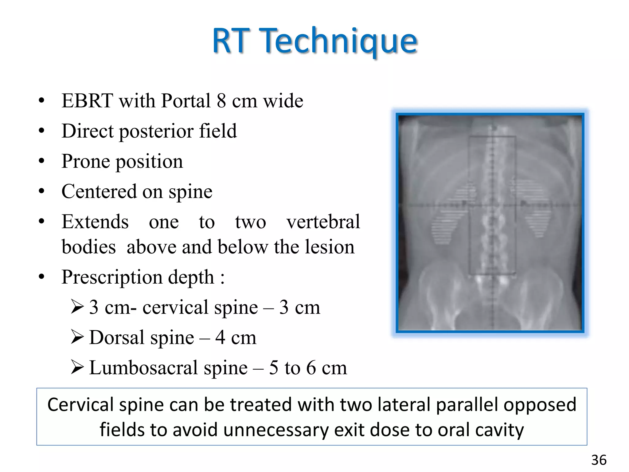 Management of malignant spinal cord compression | PPTX