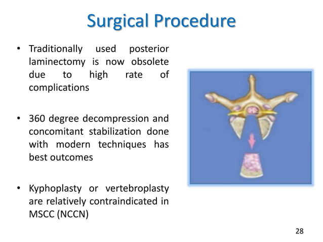 Management of malignant spinal cord compression | PPTX | Cancer | Diseases and Conditions