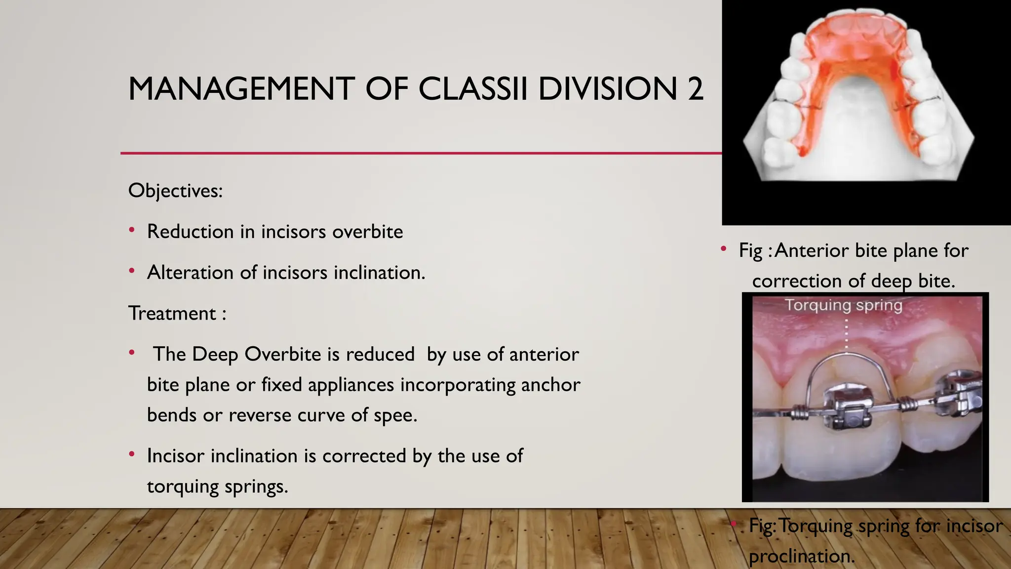 management of malocclusion in orthodontics | PPTX