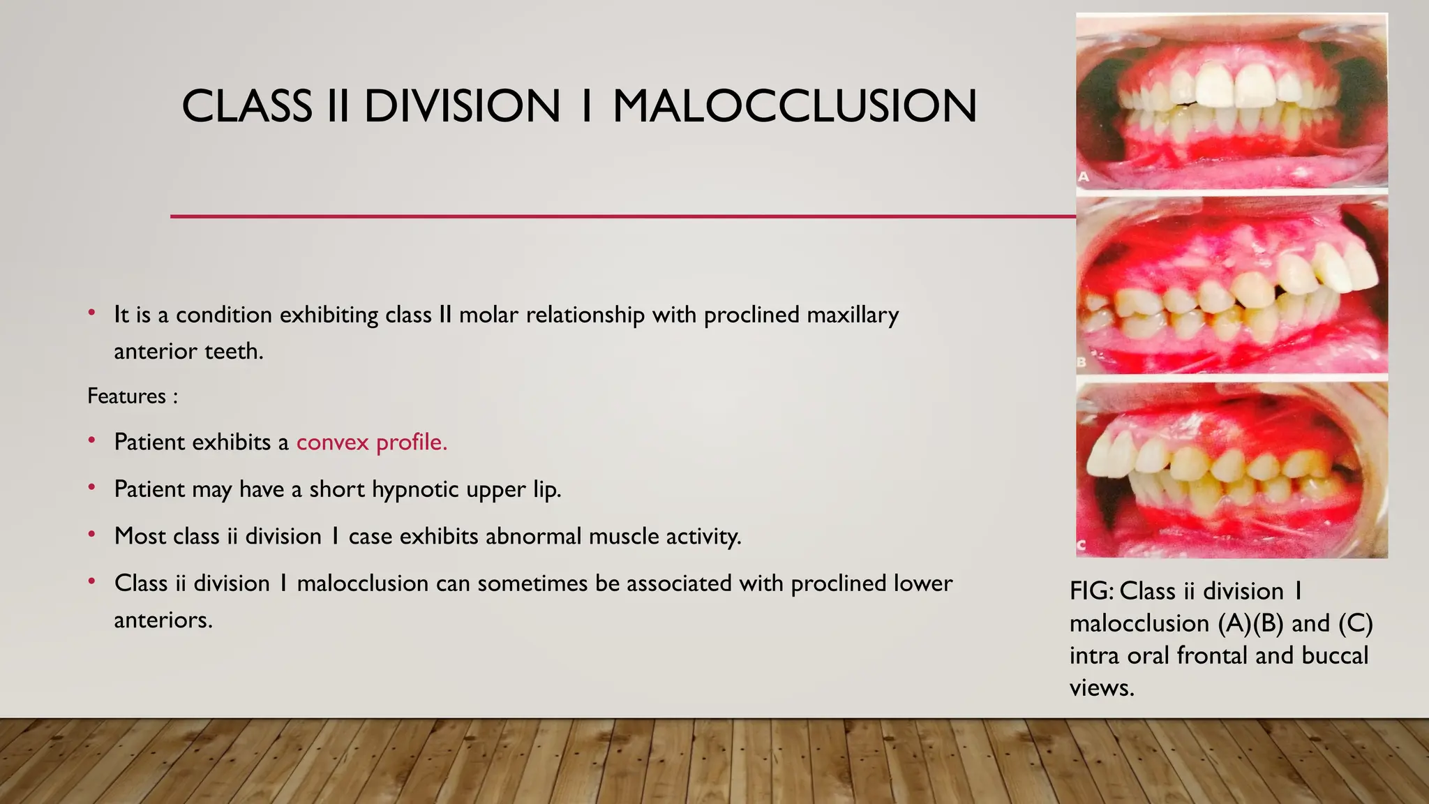 management of malocclusion in orthodontics | PPTX