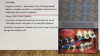 management of malocclusion in orthodontics | PPTX