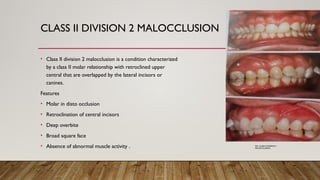 management of malocclusion in orthodontics | PPTX