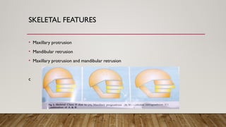 management of malocclusion in orthodontics | PPTX