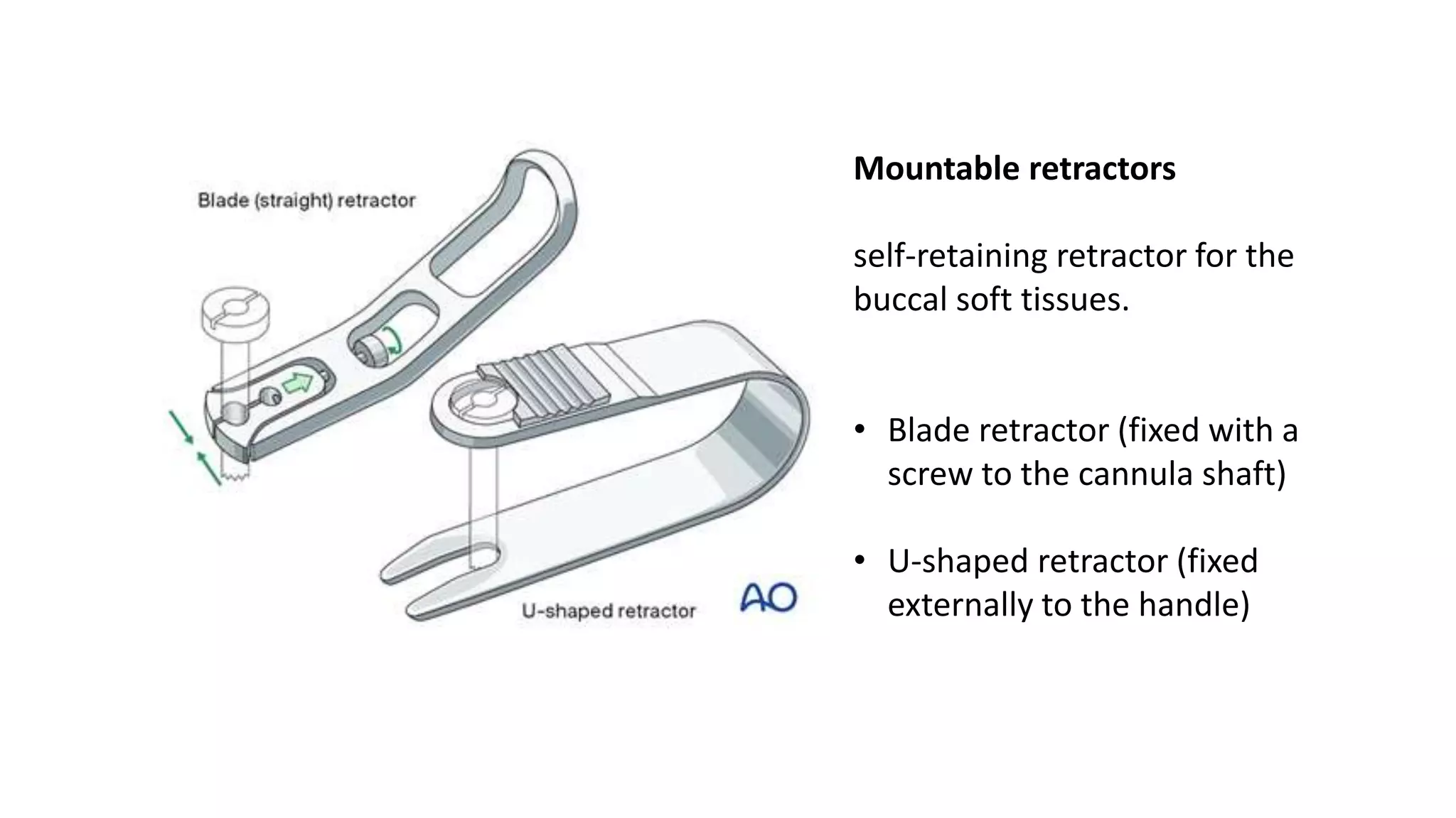 MANAGEMENT OF MANDIBULAR ANGLE FRACTURE.pptx