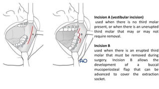 MANAGEMENT OF MANDIBULAR ANGLE FRACTURE.pptx