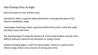 MANAGEMENT OF MANDIBULAR ANGLE FRACTURE.pptx