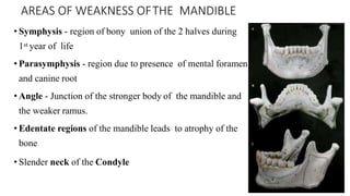 MANAGEMENT OF MANDIBULAR ANGLE FRACTURE.pptx