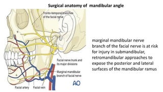 MANAGEMENT OF MANDIBULAR ANGLE FRACTURE.pptx
