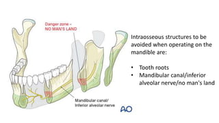 MANAGEMENT OF MANDIBULAR ANGLE FRACTURE.pptx