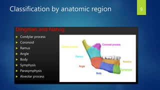 Management of Mandibular Fractures | PPTX