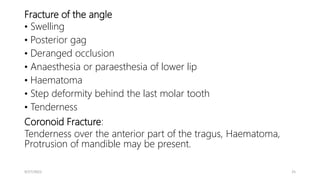 Management of Mandibular fractures.pptx