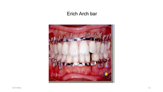 Management of Mandibular fractures.pptx