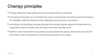 Management of Mandibular fractures.pptx