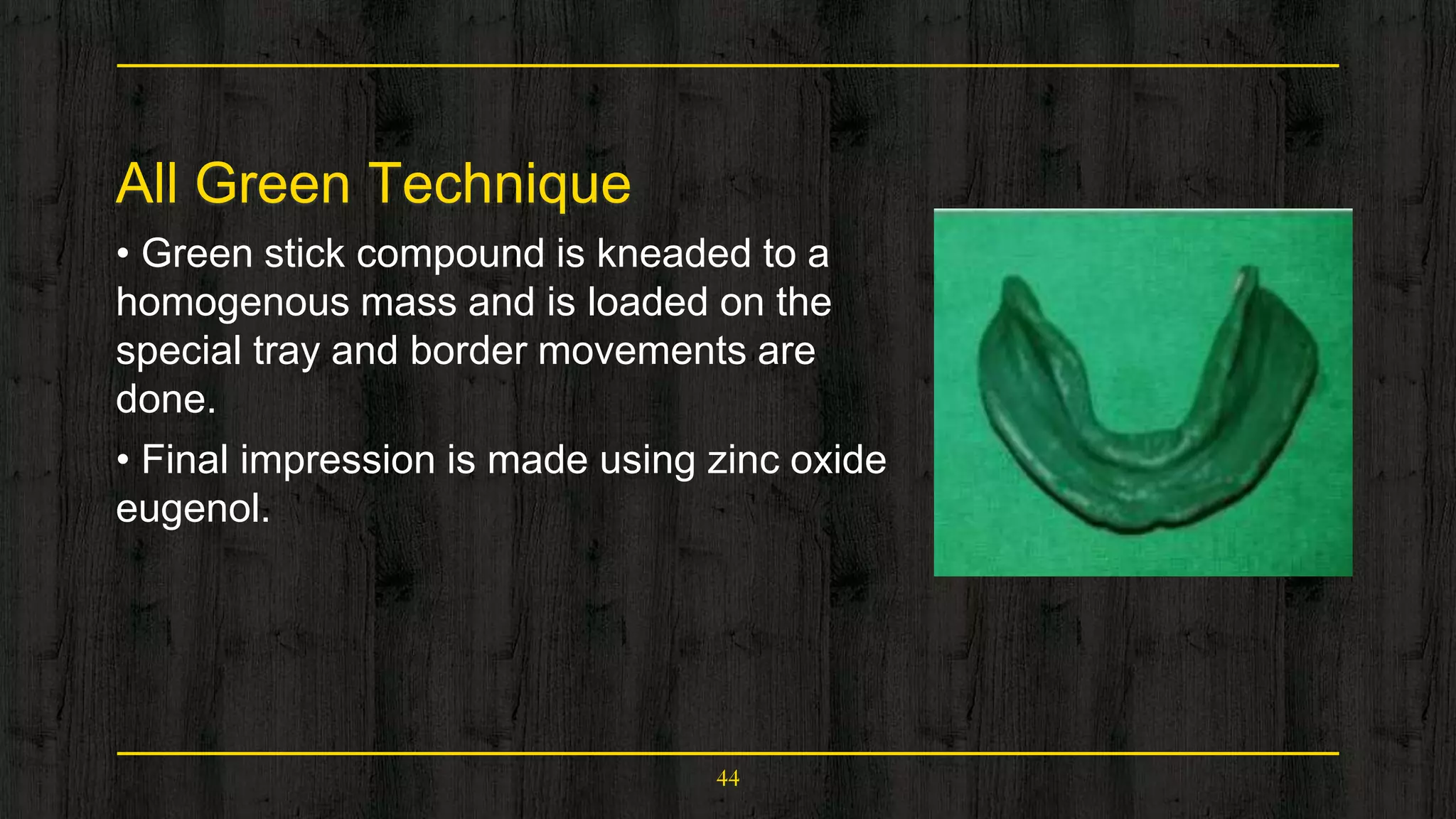 Management of mandibular rr | PPTX