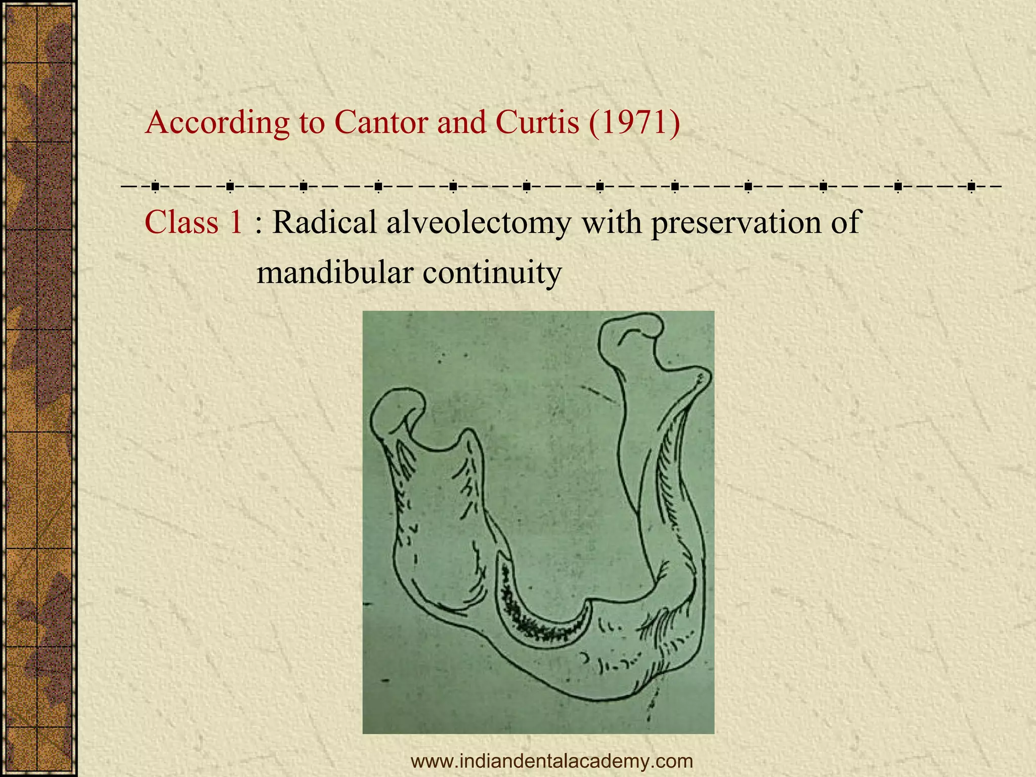 Management of mandibulectomy / /certified fixed orthodontic courses by ...