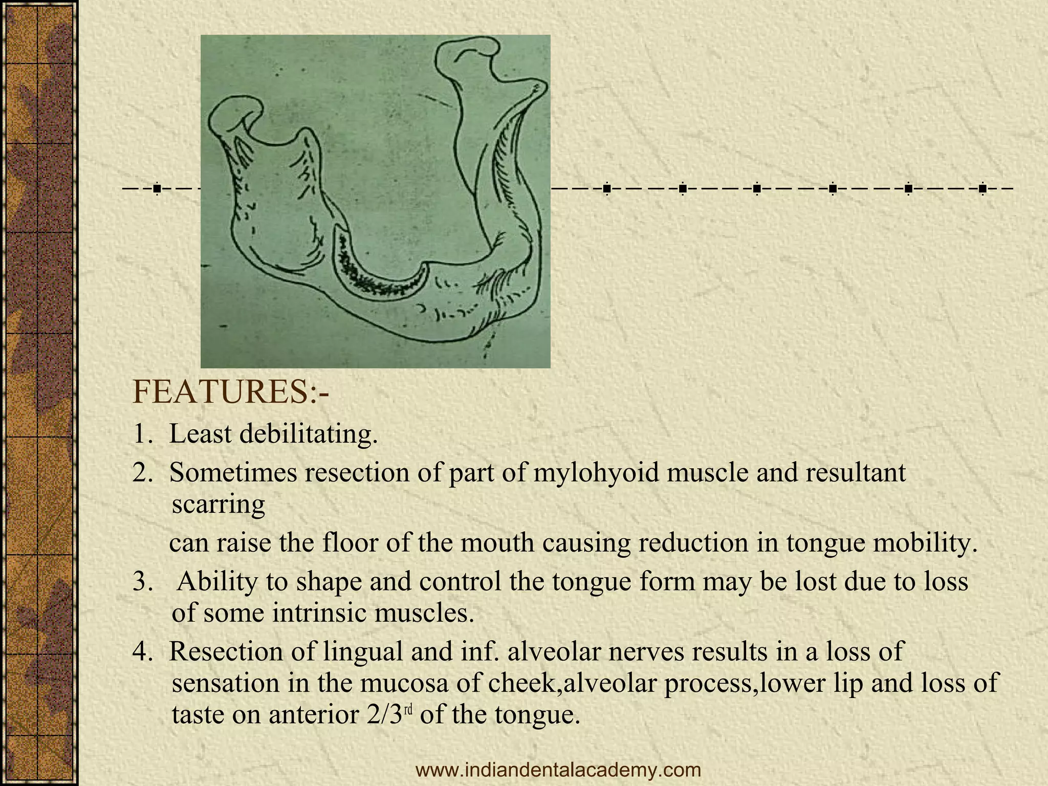 Management of mandibulectomy / /certified fixed orthodontic courses by ...