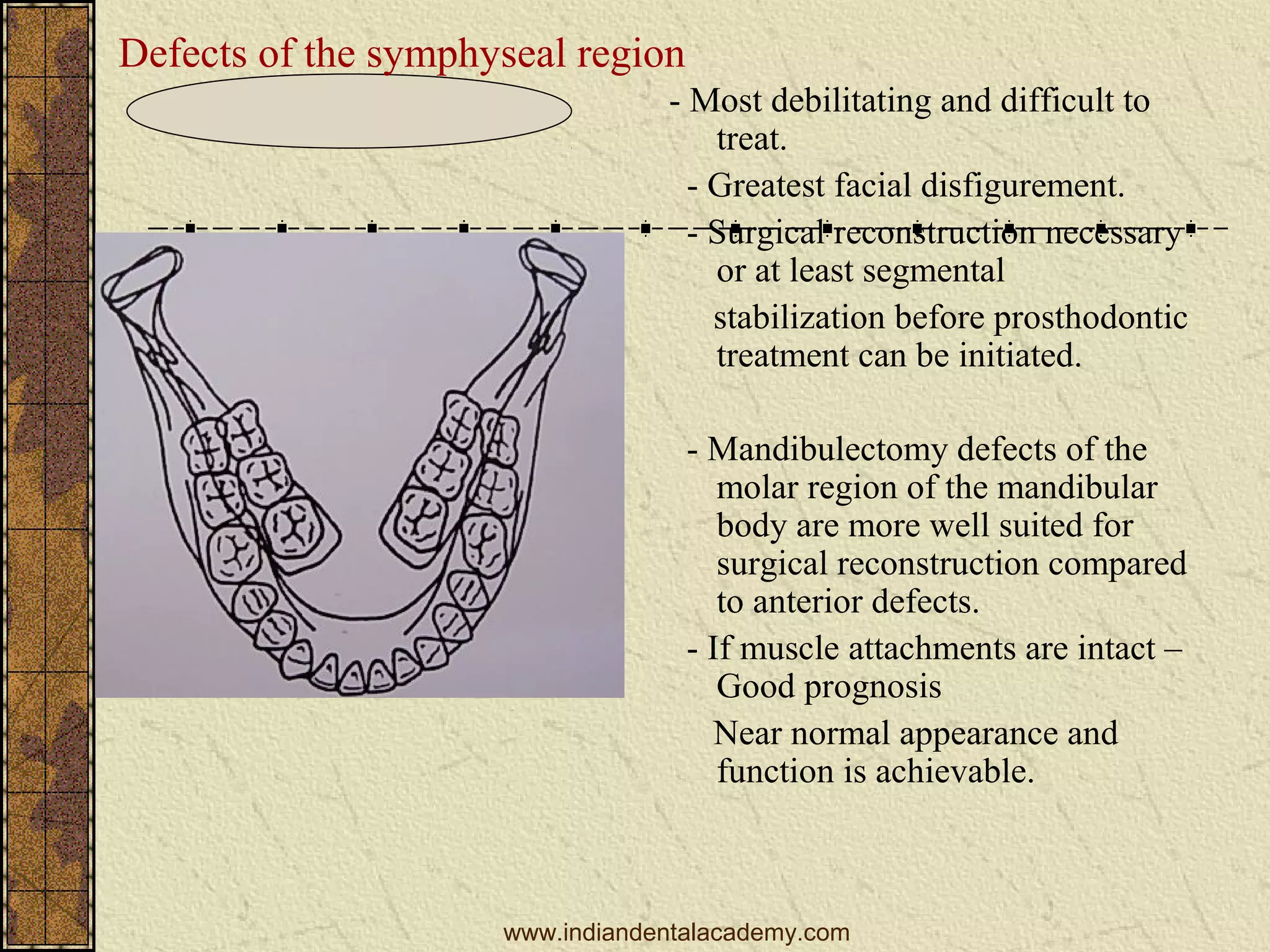 Management of mandibulectomy / /certified fixed orthodontic courses by ...