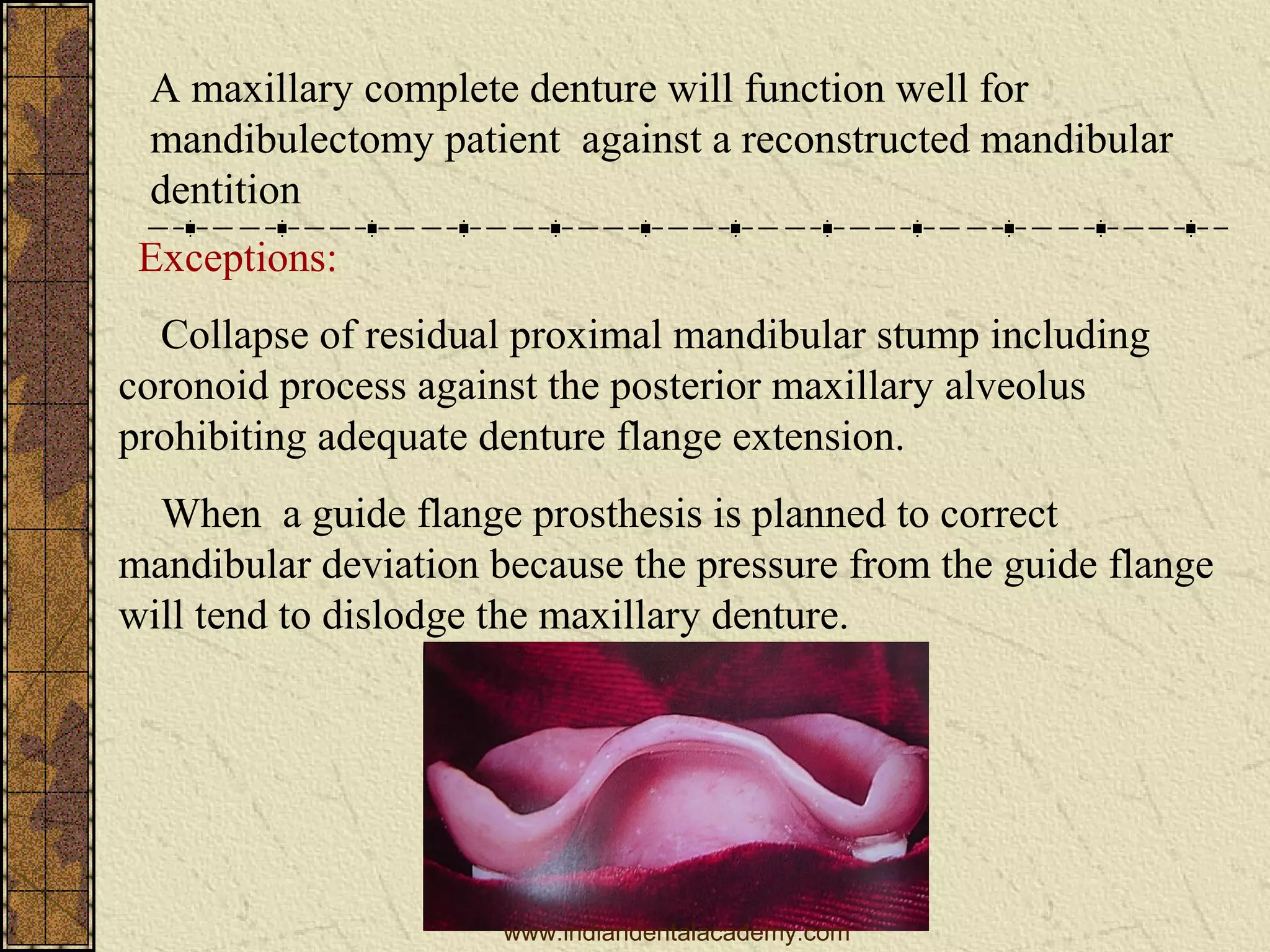 Management of mandibulectomy / /certified fixed orthodontic courses by ...