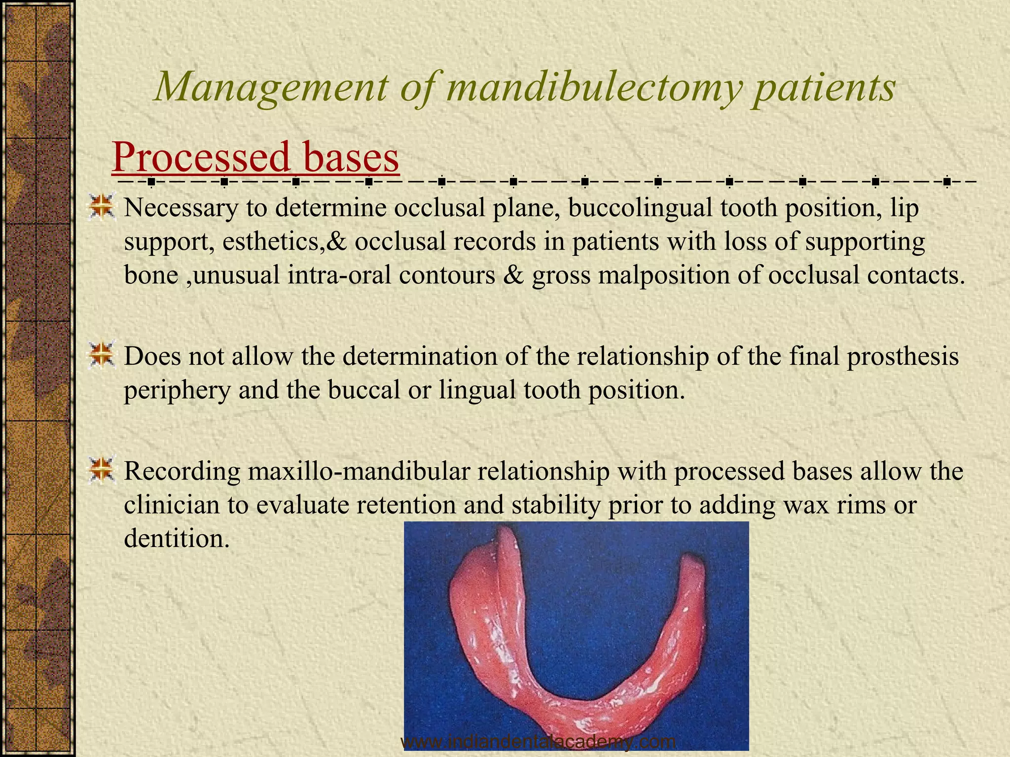 Management of mandibulectomy / /certified fixed orthodontic courses by ...