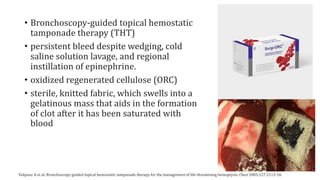 Management of massive hemoptysis.pptx
