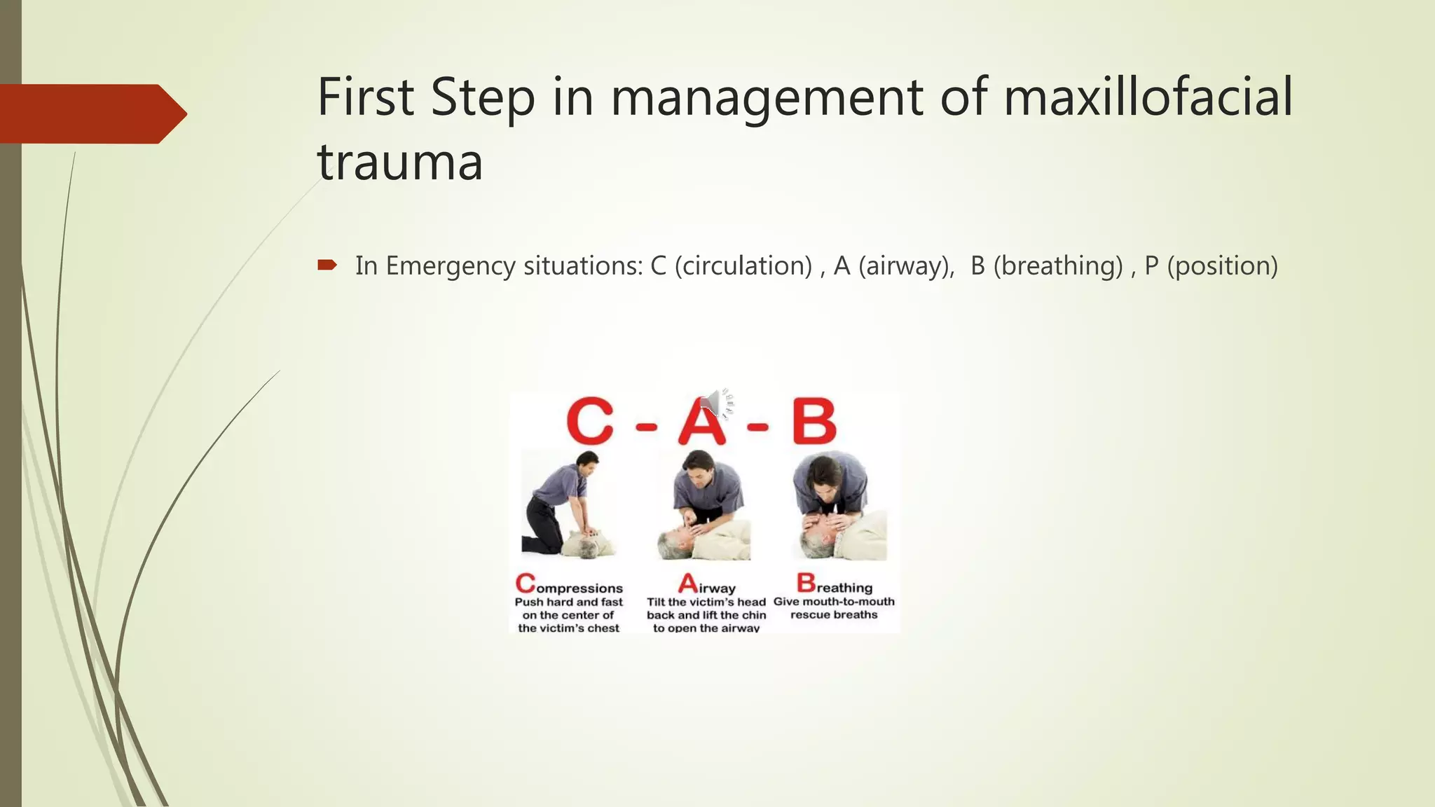 Management of maxillofacial trauma | PPTX