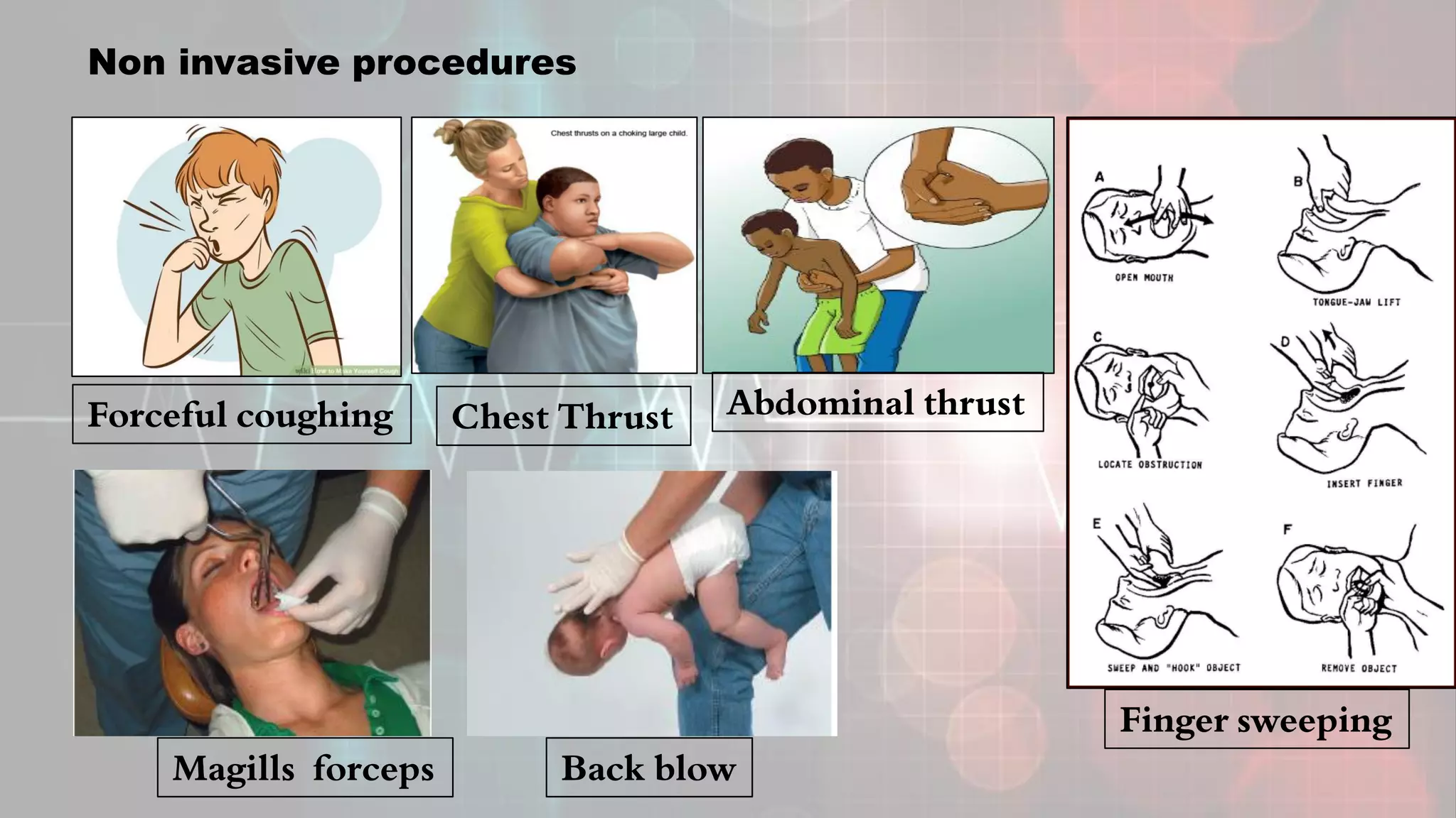 Management of medical emergencies | PDF