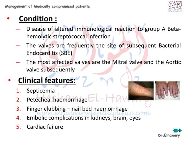 Management of medically compromised patients | PPTX