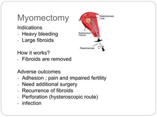 Management of menorrhagia | PPTX