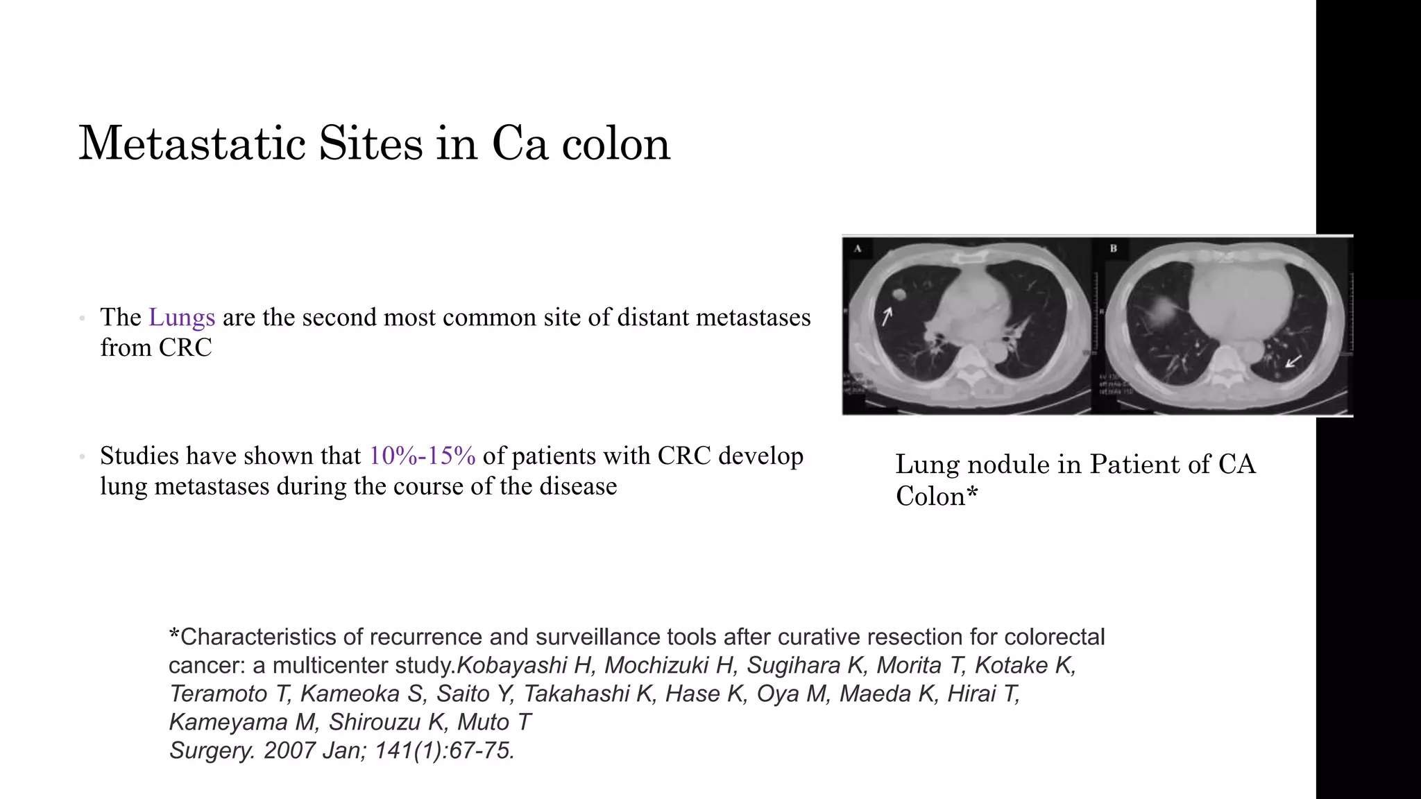 management of metastatic ca colon with chemotherapy evolution in ca ...