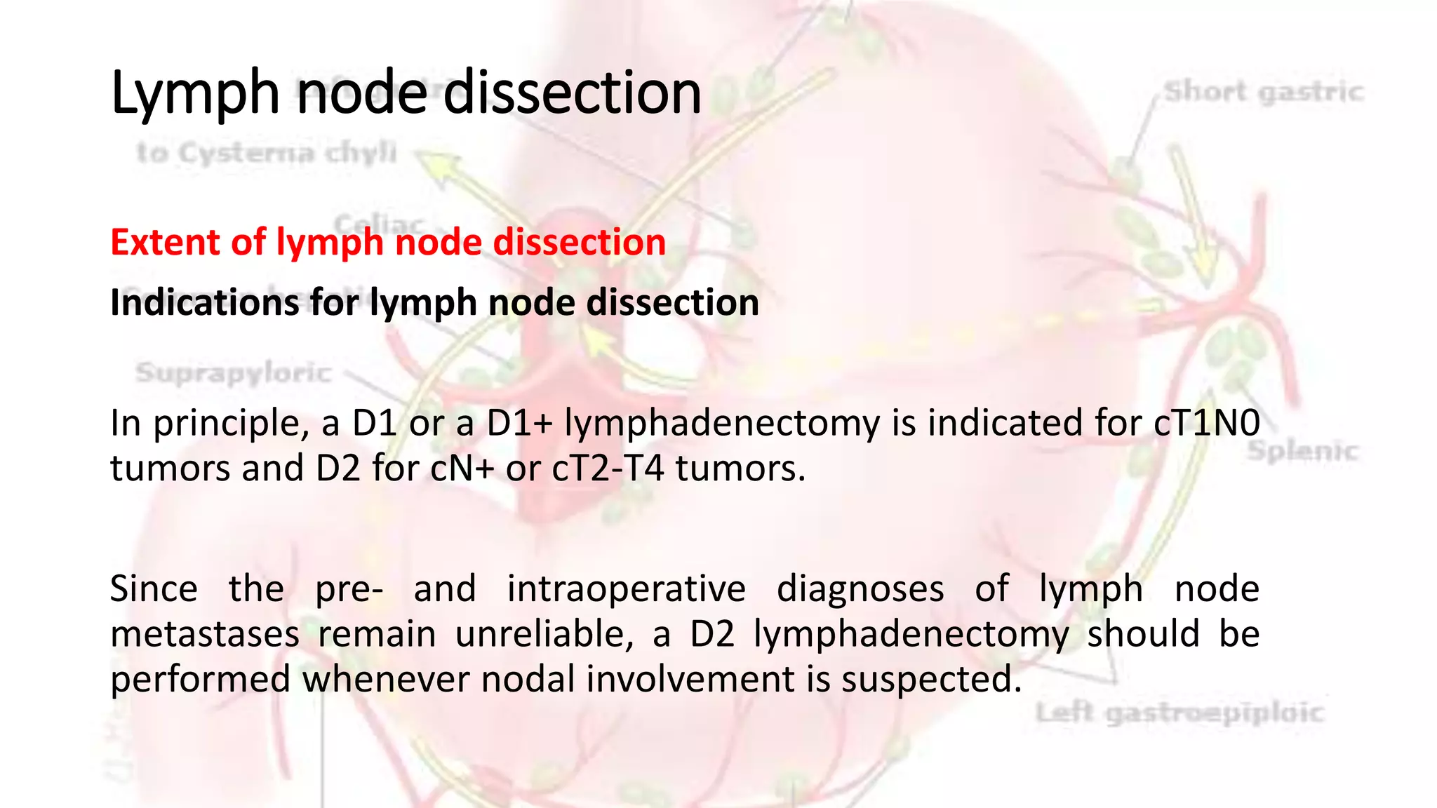 Management of metastatic lymph nodes in gastric cancer | PPTX