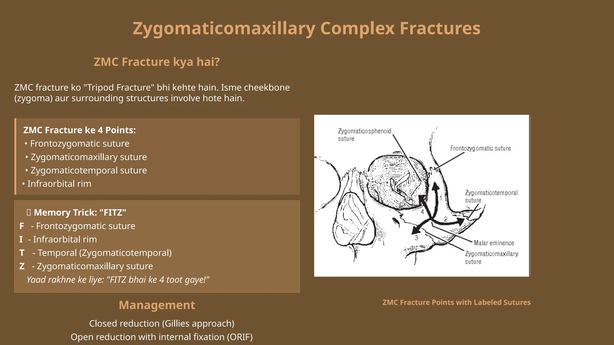 Management_of_Mid_Face_Fractures OS.pptx