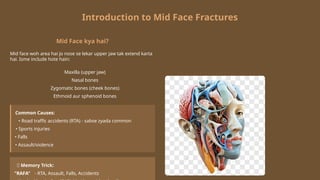 Management_of_Mid_Face_Fractures OS.pptx