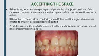 Management of missing maxillary lateral incisor | PPTX