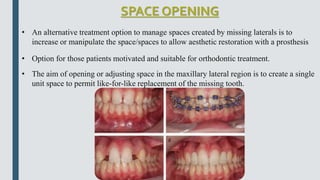 Management of missing maxillary lateral incisor | PPT