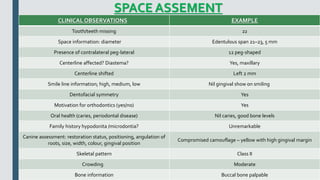Management of missing maxillary lateral incisor | PPTX