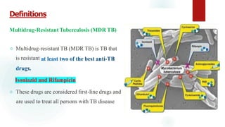 Management of multi drug resistant tuberculosis | PPTX