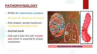 Management of multi drug resistant tuberculosis | PPTX