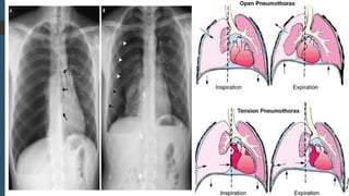 Management of multiple trauma | PPTX
