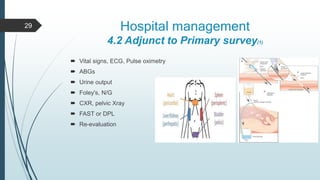 Management of multiple trauma | PPTX