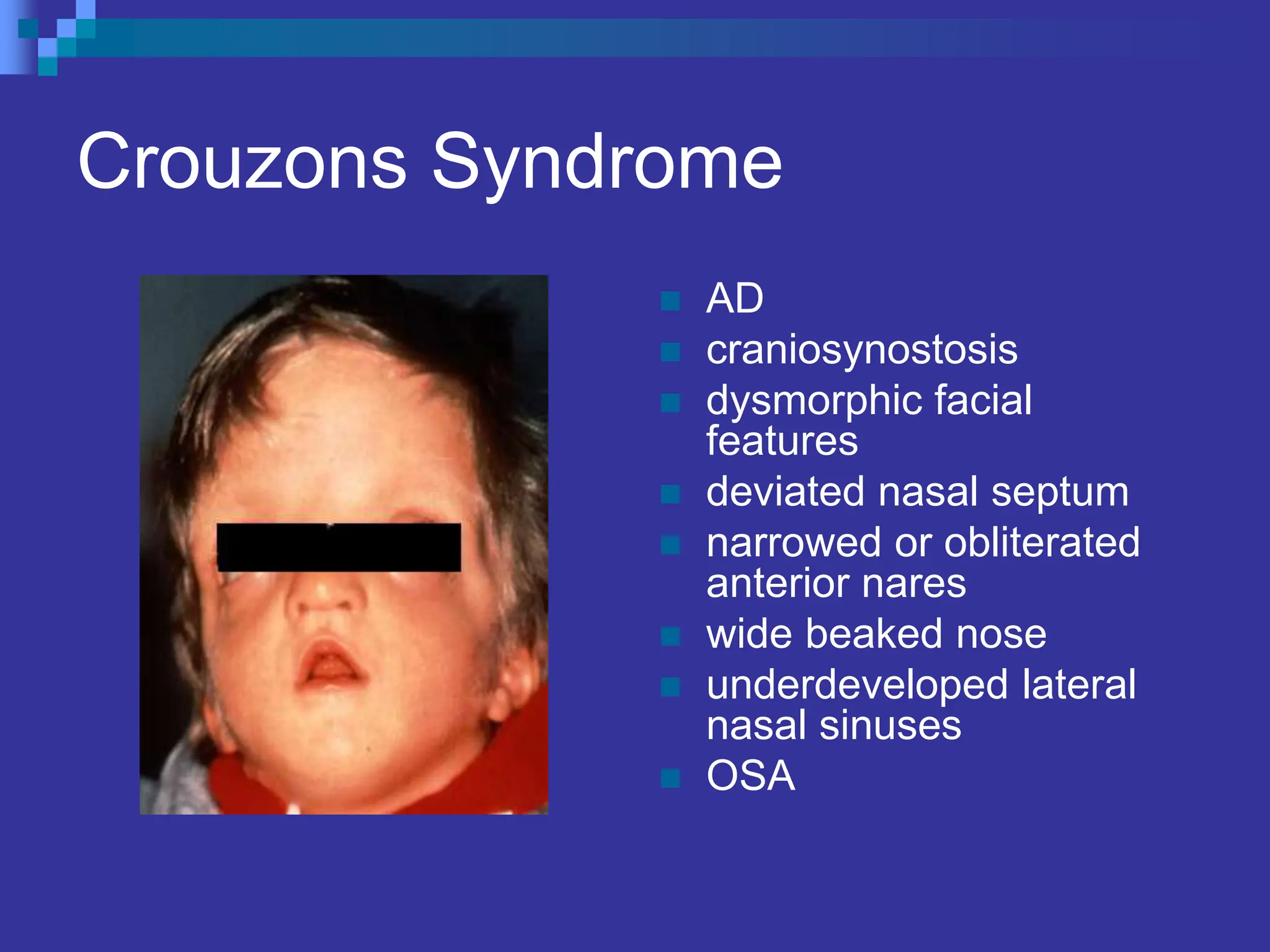 Management of Nasal Obstruction.ppt