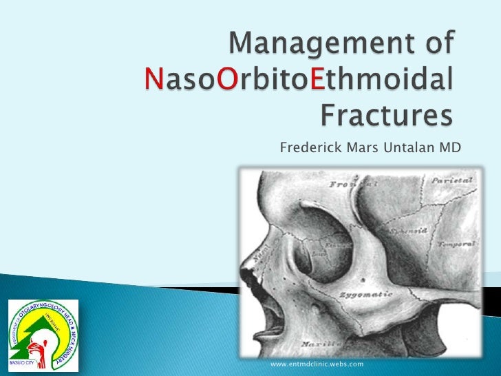 Management of nasoethmoidal fractures