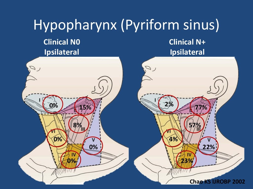 Management of neck: A radiation oncologist's perspective