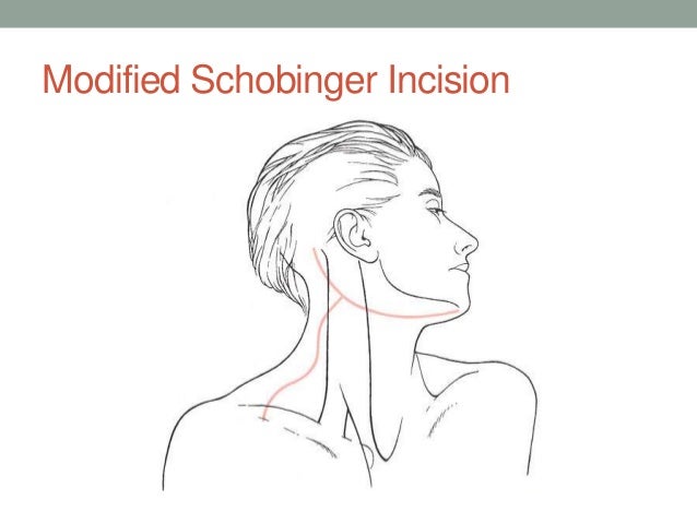 Management of neck metastasis (1)