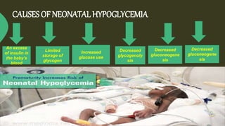 Management of neonatal hypoglycemia | PPTX
