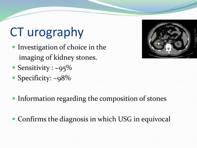 Management of nephrolithiasis | PPTX