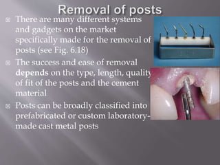 Management of non surgical root-canal treatment failure | PPTX