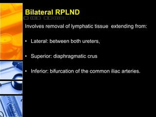 Management of Non Seminomatous Germ cell tumors of Testis (by Dr. Akhil ...