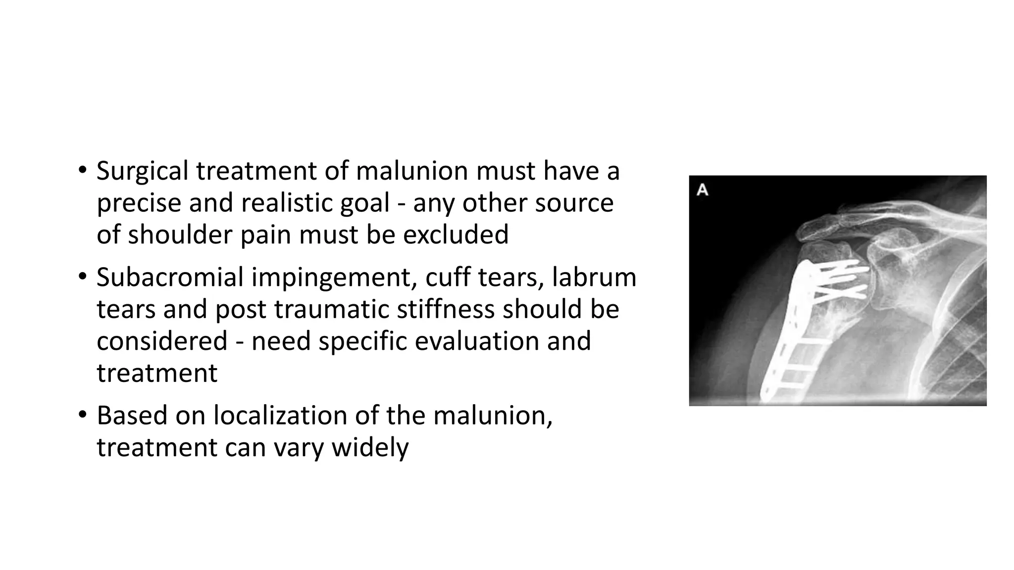 MANAGEMENT OF NONUNIONS AND MALUNIONS OF PROXIMAL HUMERAL FRACTURES.pptx